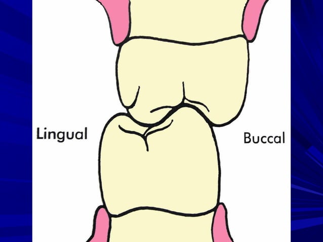 Primary teeth and occlusion | PPT | Dental Health | Diseases and Conditions