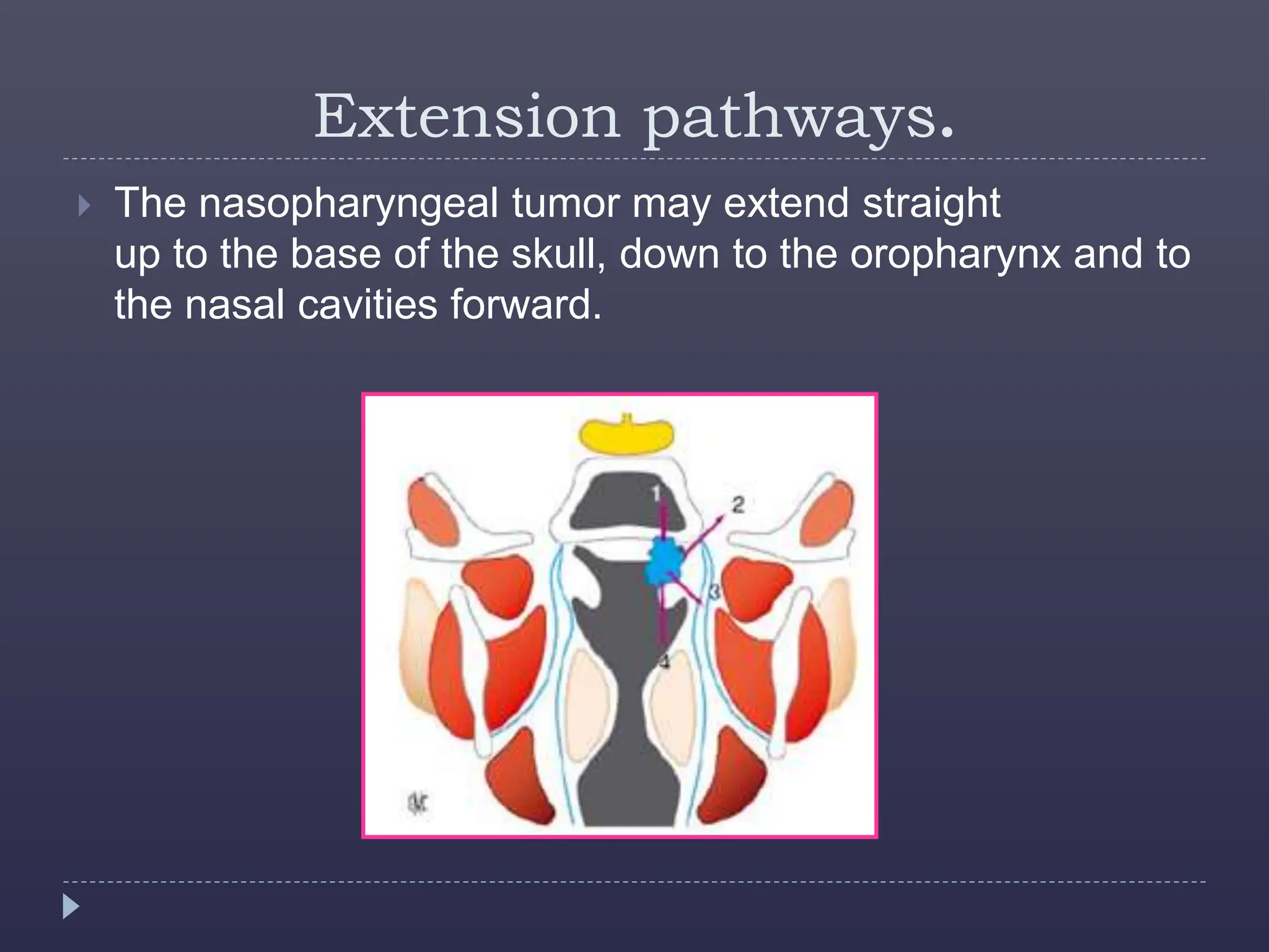 Nasopharyngeal carcinoma an importamnt cancer of nasopharynx | PPT ...