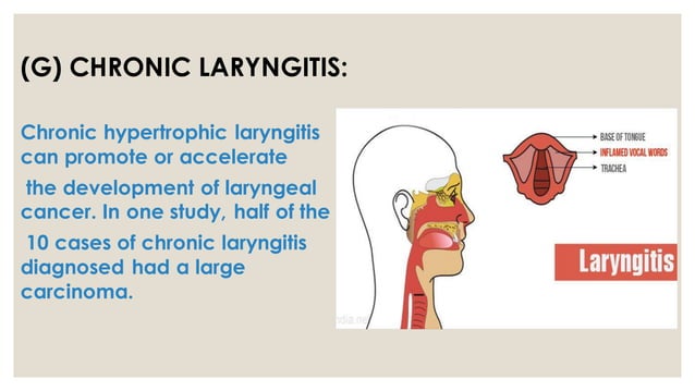 Laryngeal Cancer/Larynx cancer description including introduction ...