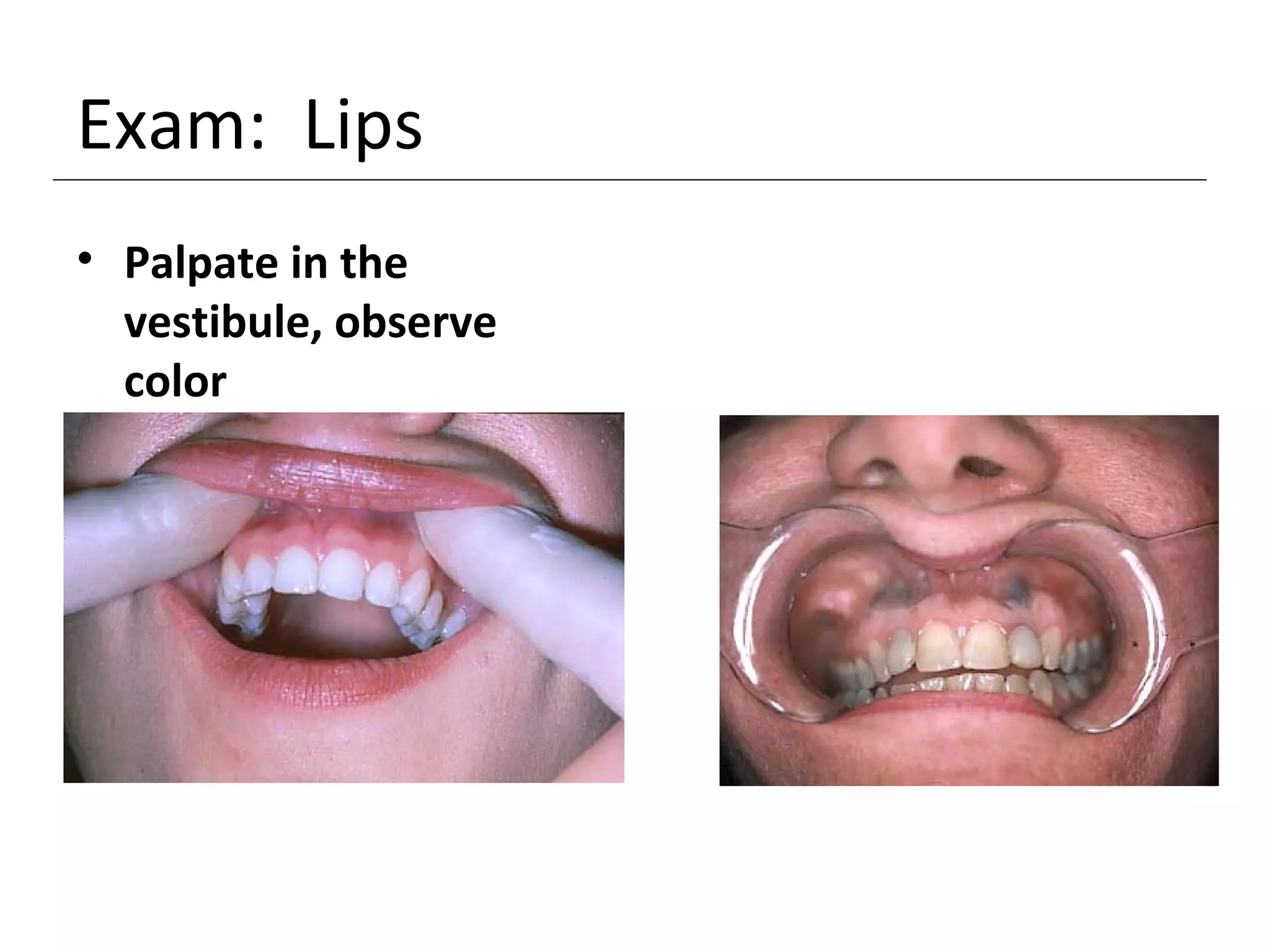 Examination of the oral cavity | PPT