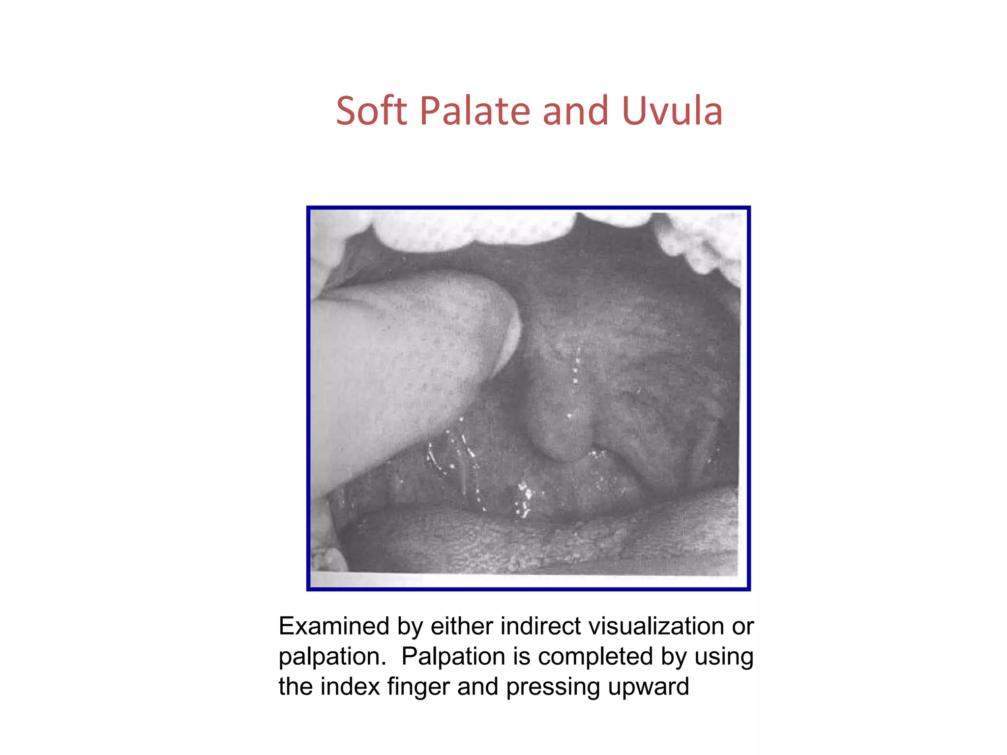 Examination of the oral cavity | PPT