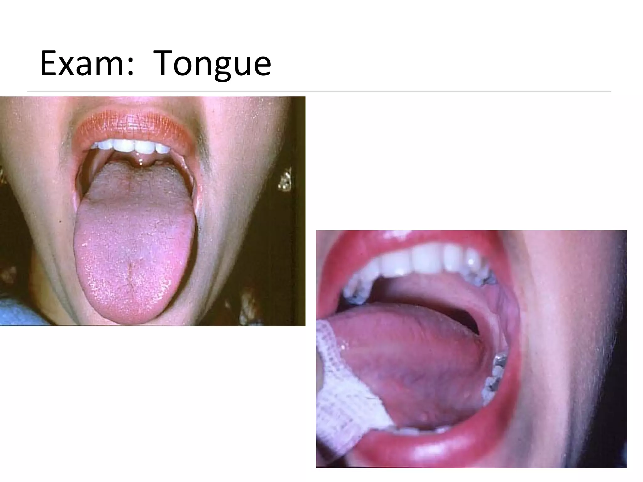 Examination of the oral cavity | PPT