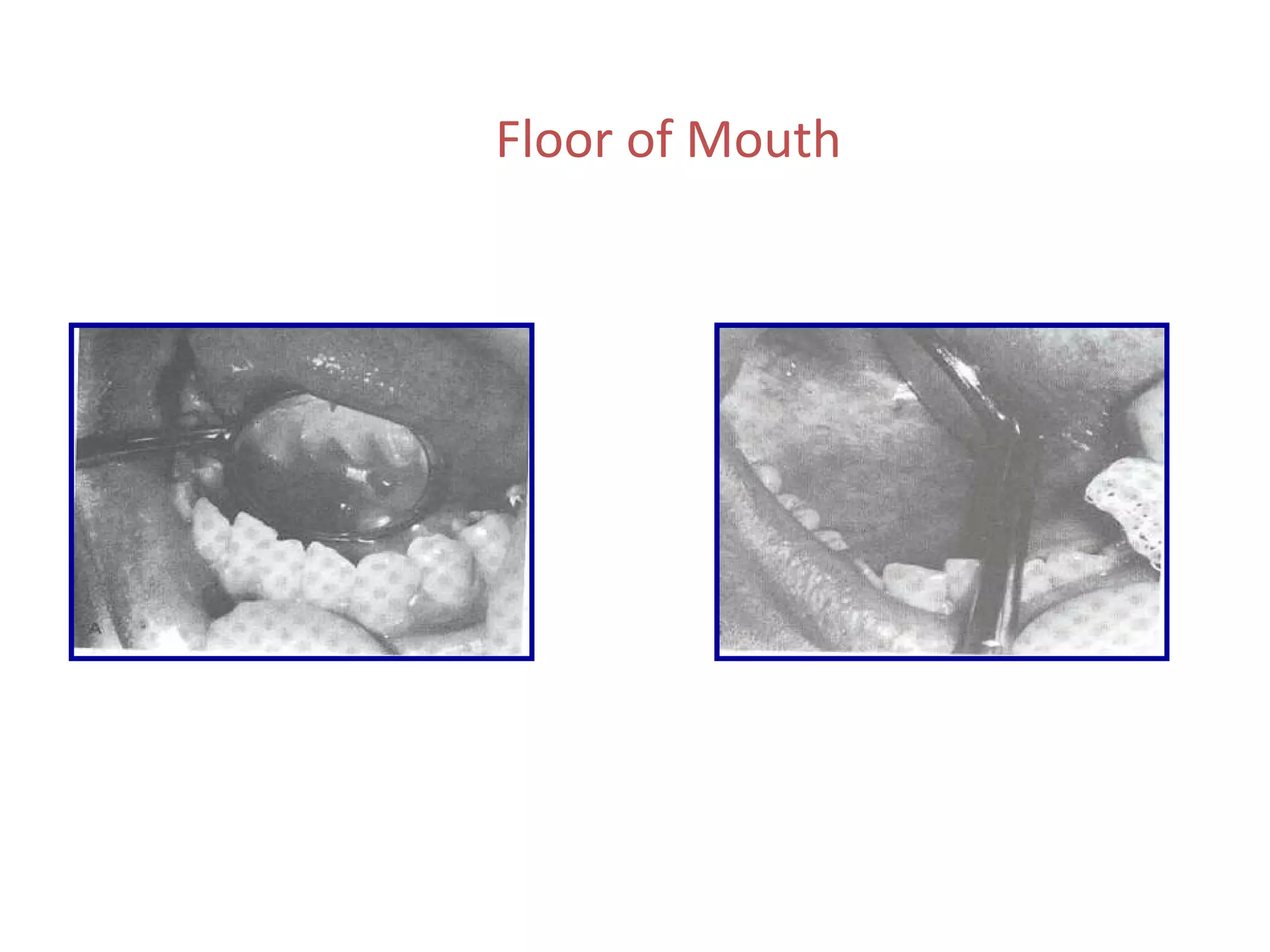 Examination of the oral cavity | PPT