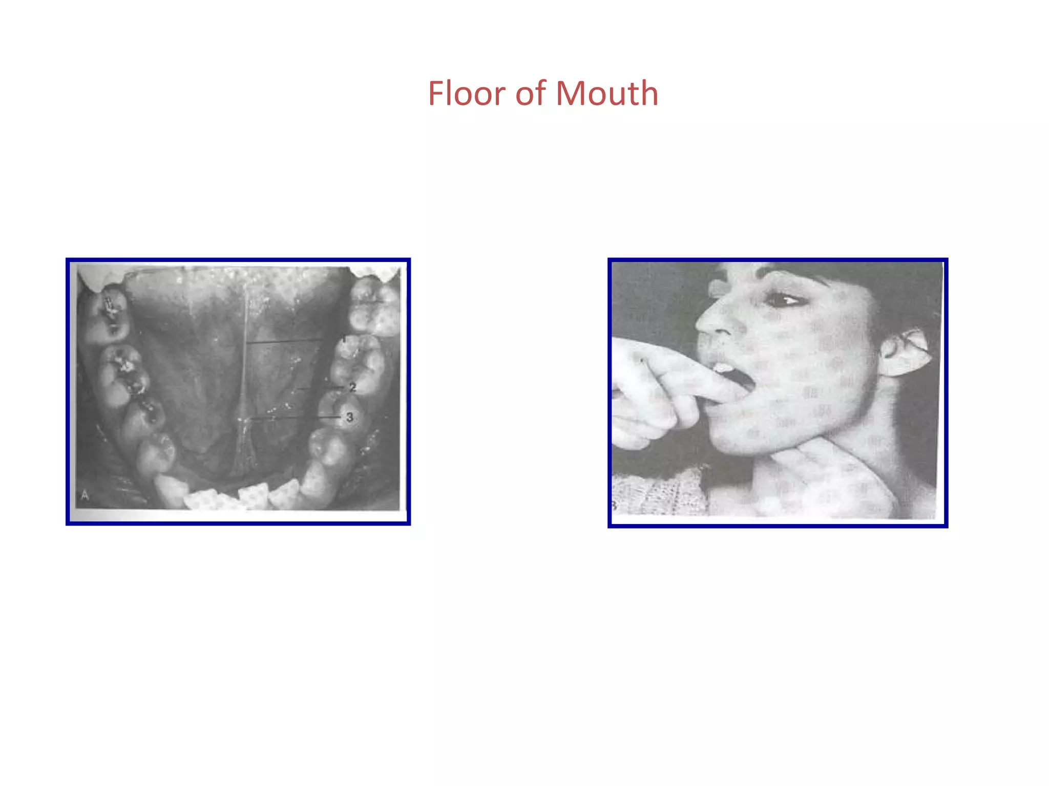 Examination of the oral cavity | PPT