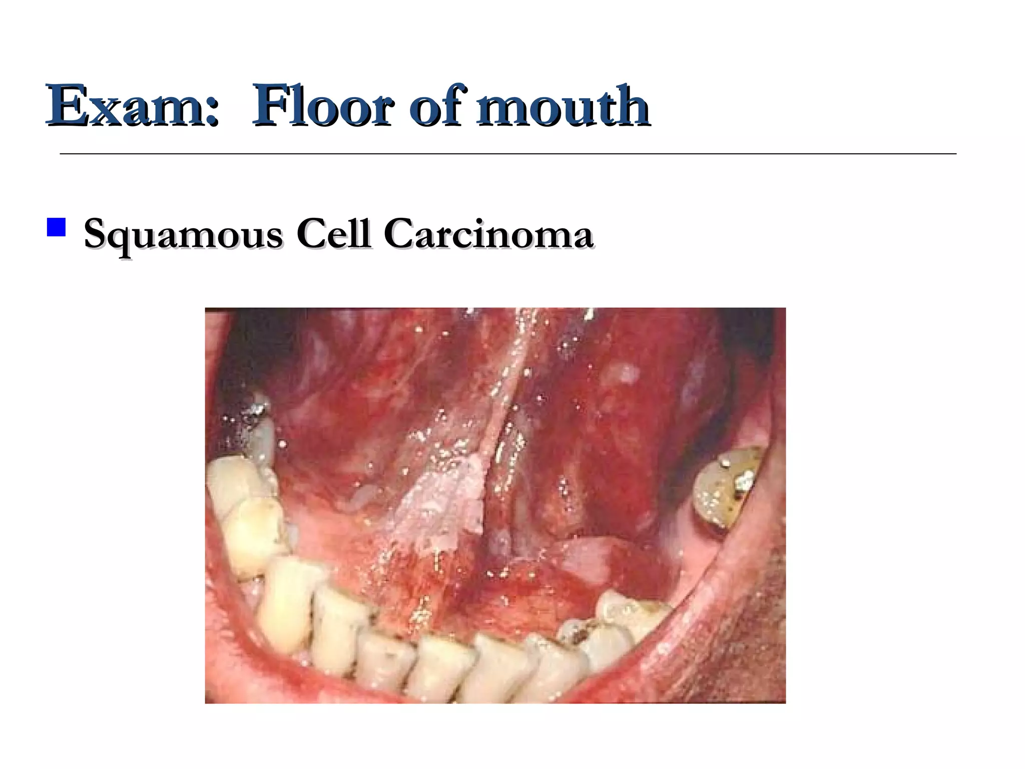 Examination of the oral cavity | PPT