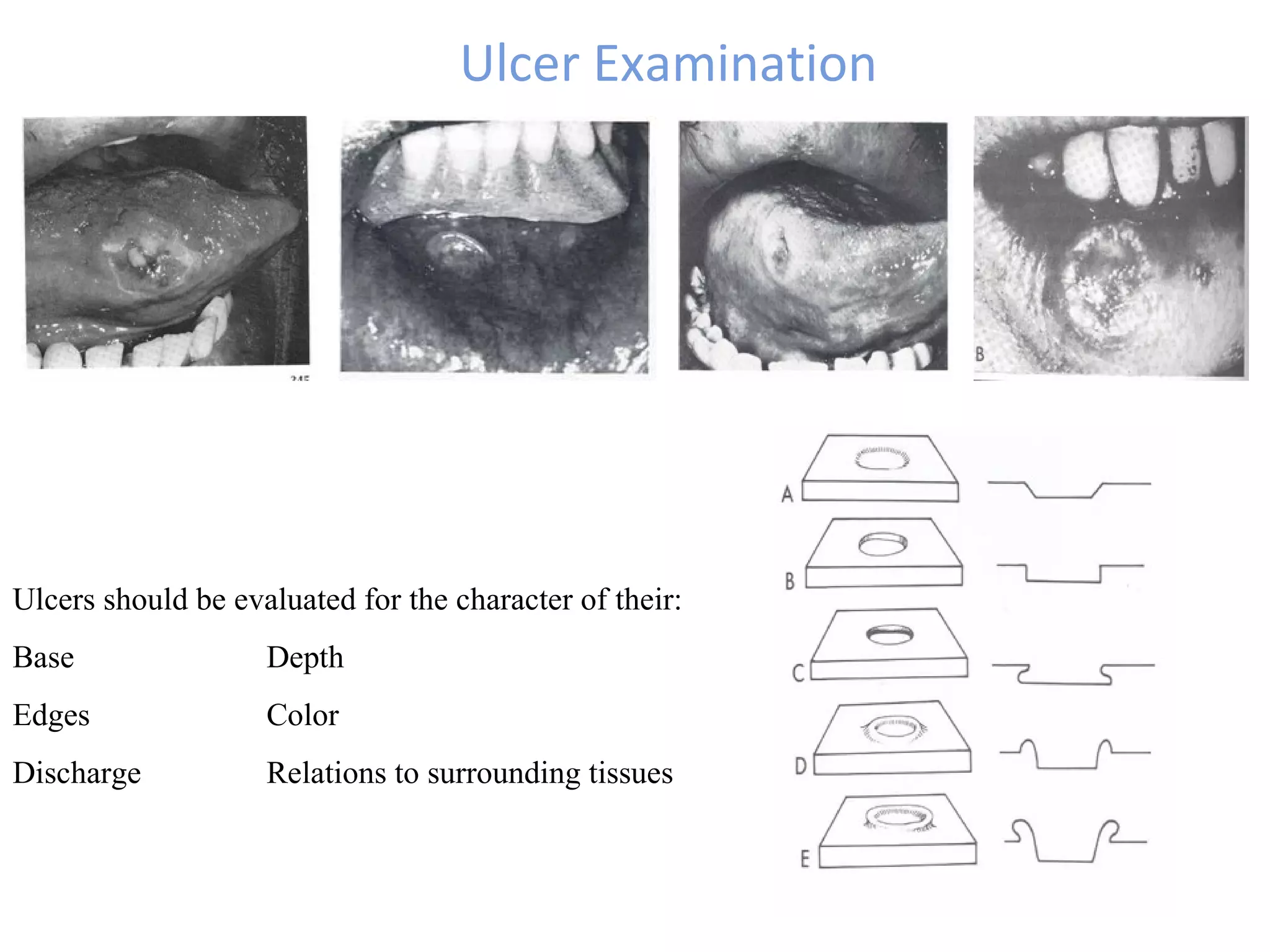 Examination of the oral cavity | PPT
