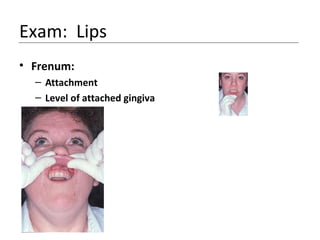 Examination of the oral cavity | PPT