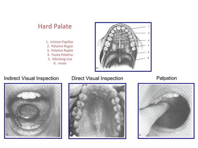 Examination of the oral cavity | PPT