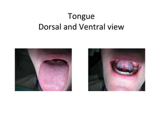 Examination of the oral cavity | PPT