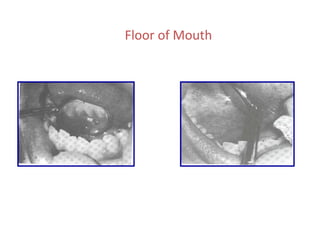 Examination of the oral cavity | PPT