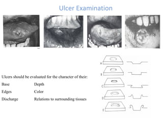 Examination of the oral cavity | PPT