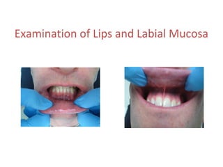Examination of the oral cavity | PPT
