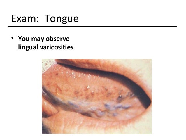Examination of the oral cavity