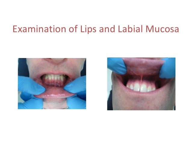 Examination of the oral cavity