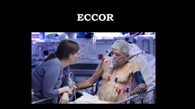 ECMO for cardiac arrest | PPT