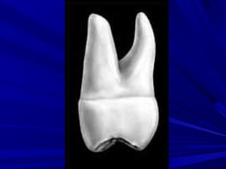 Maxillary second and third molars | PPT