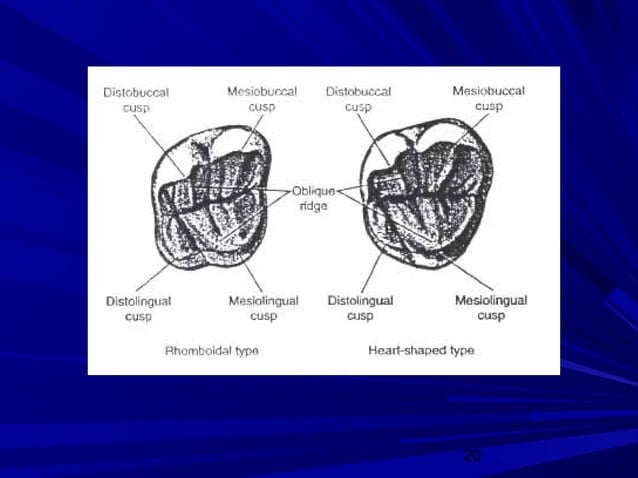 Maxillary second and third molars