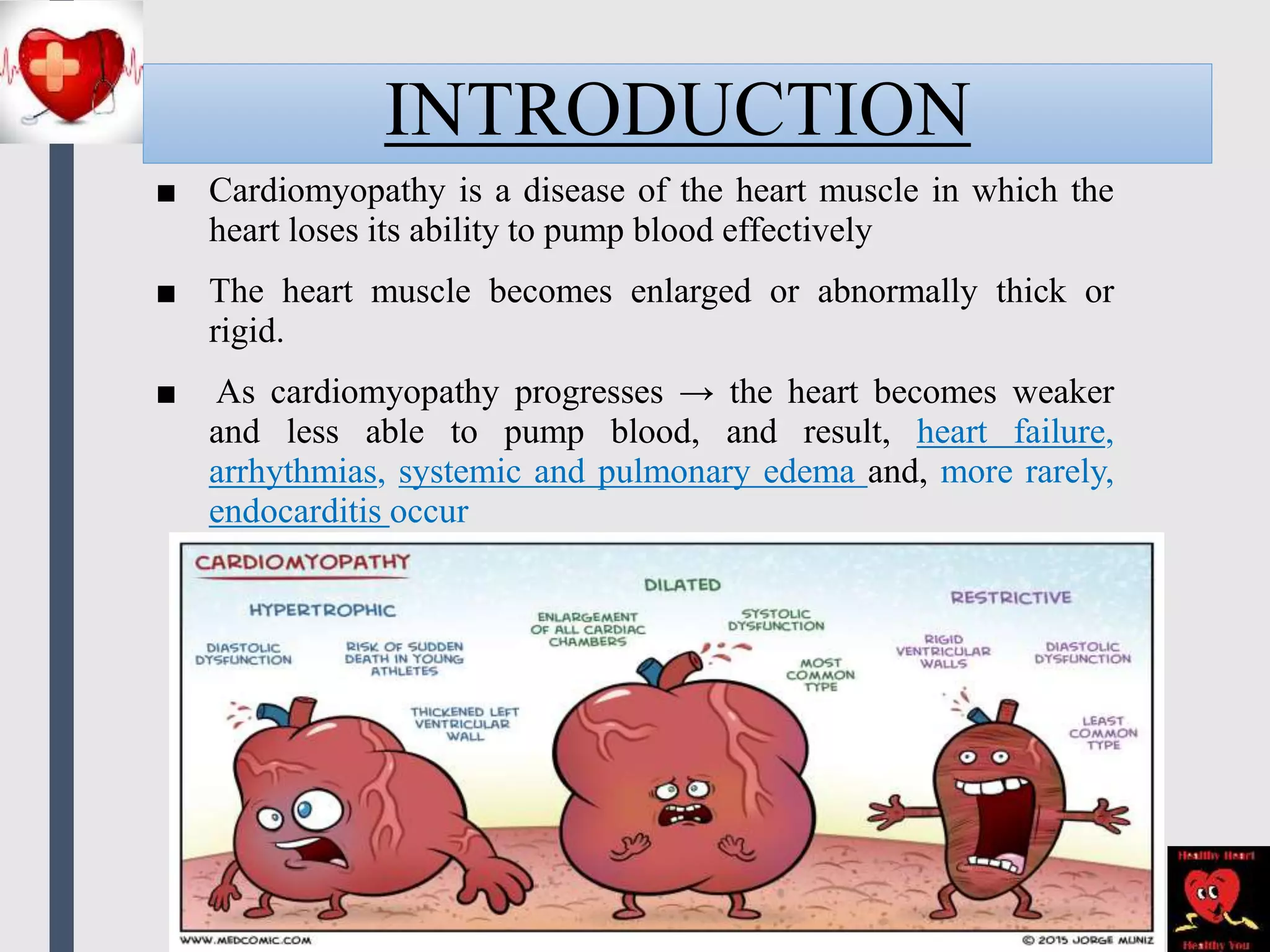 Hypertrophic Cardiomyopathy | PPTX