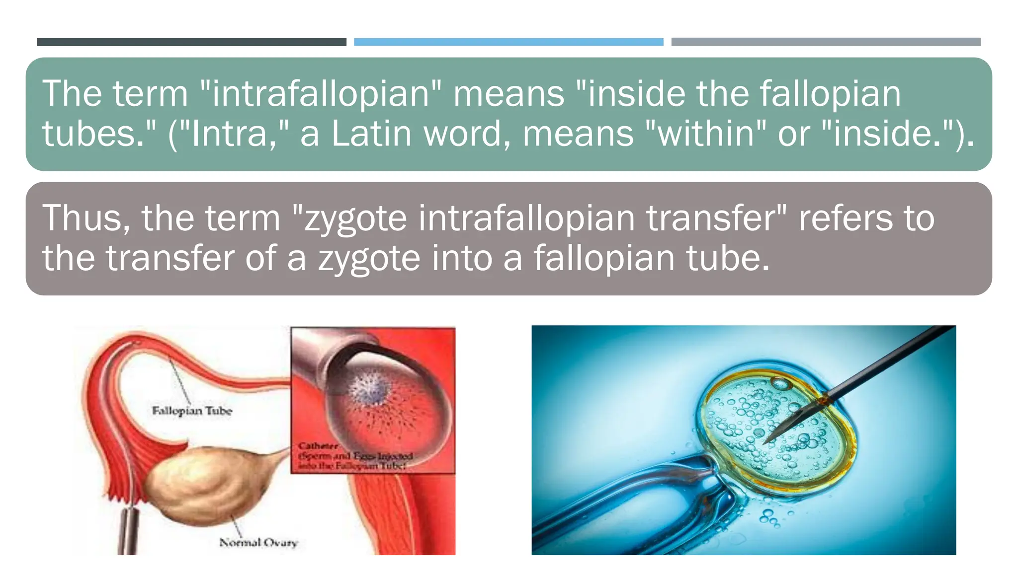 zygote interfelloporin transfer. Z*FT ppt | PDF | Pregnancy ...