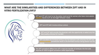 zygote interfelloporin transfer. Z*FT ppt | PDF | Pregnancy ...