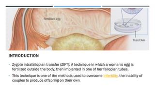 zygote interfelloporin transfer. Z*FT ppt | PDF | Pregnancy ...