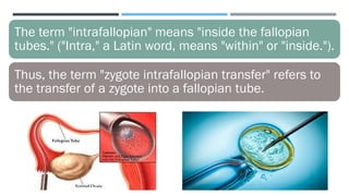 zygote interfelloporin transfer. Z*FT ppt | PDF | Pregnancy ...