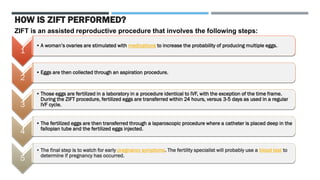 zygote interfelloporin transfer. Z*FT ppt | PDF | Pregnancy ...