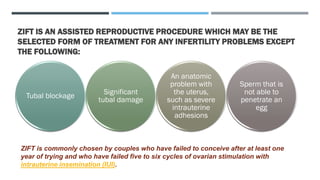zygote interfelloporin transfer. Z*FT ppt | PDF | Pregnancy ...