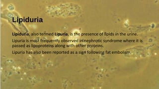 Chapter 2 lipids | PPT