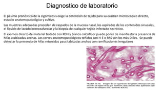 Zigocomicosis | PPT