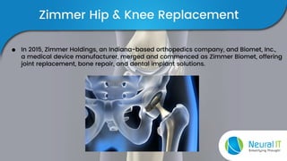 Zimmer Hip Replacement Lawsuits: Status – DZED
