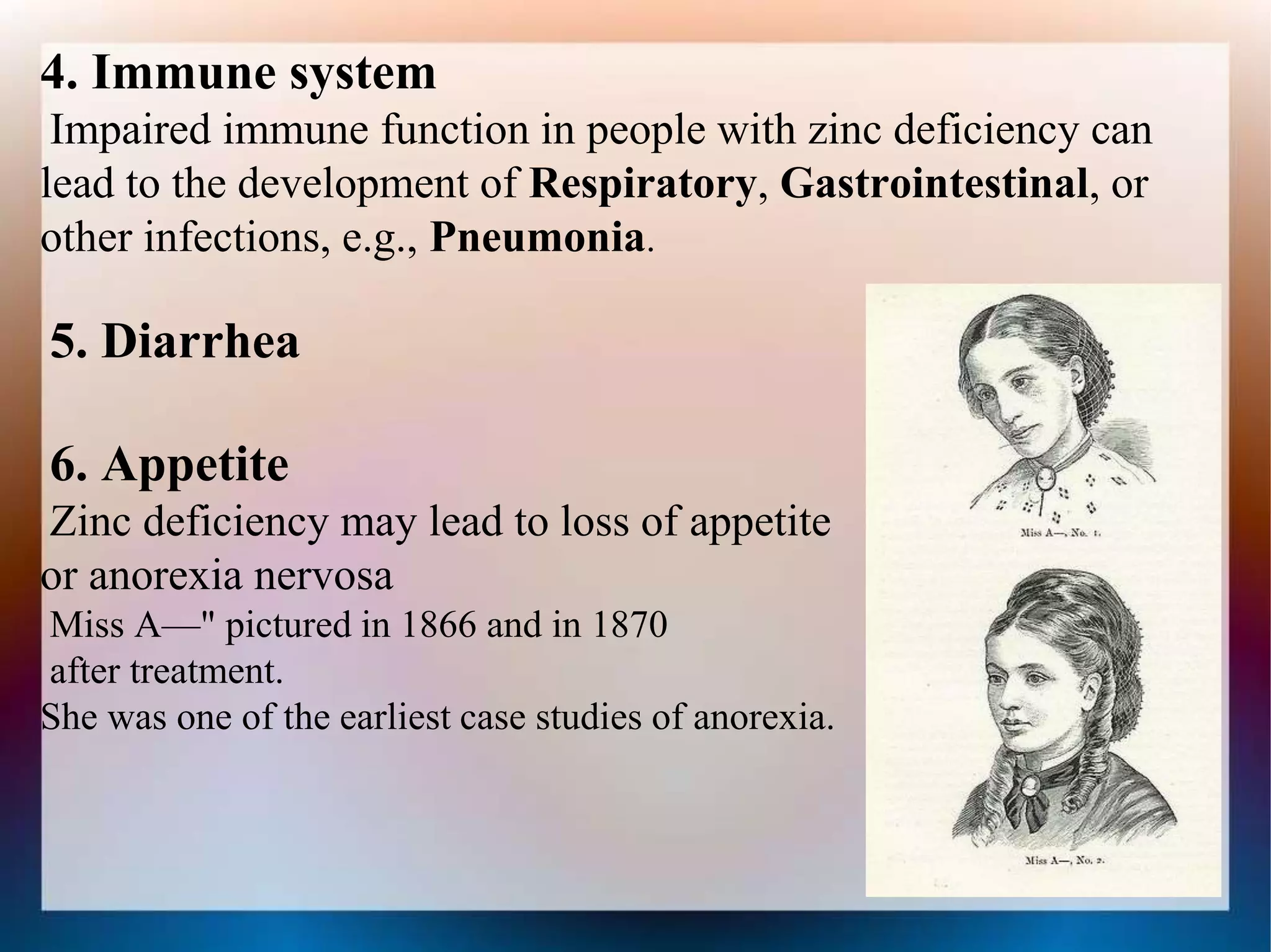 Zinc Deficiency | PPTX