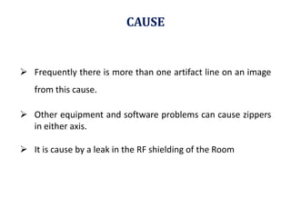 Zipper artifact | PPTX