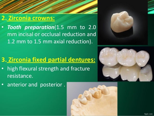 Zirconia Crown Prep
