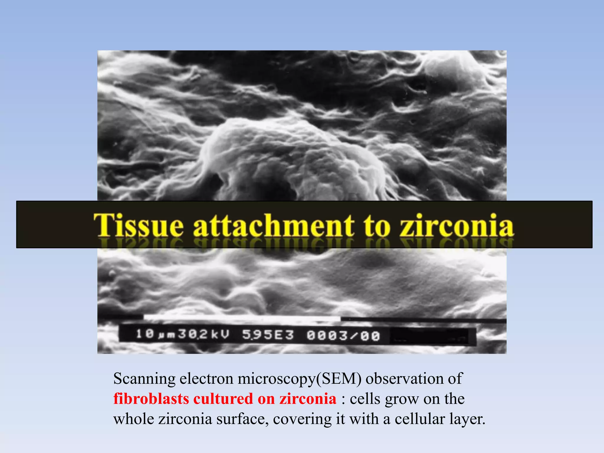 Zirconia crowns for primary anterior and posterior teeth | PPTX