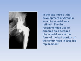 Zirconia crowns for primary anterior and posterior teeth | PPTX