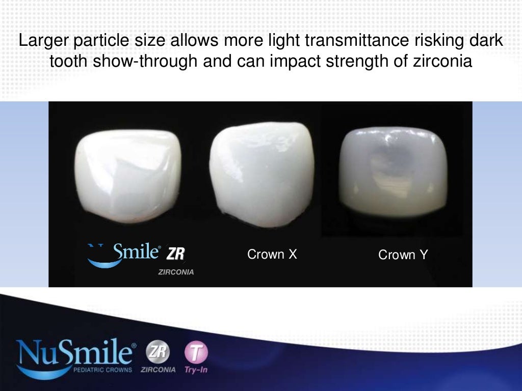 Zirconia crowns for primary anterior and posterior teeth