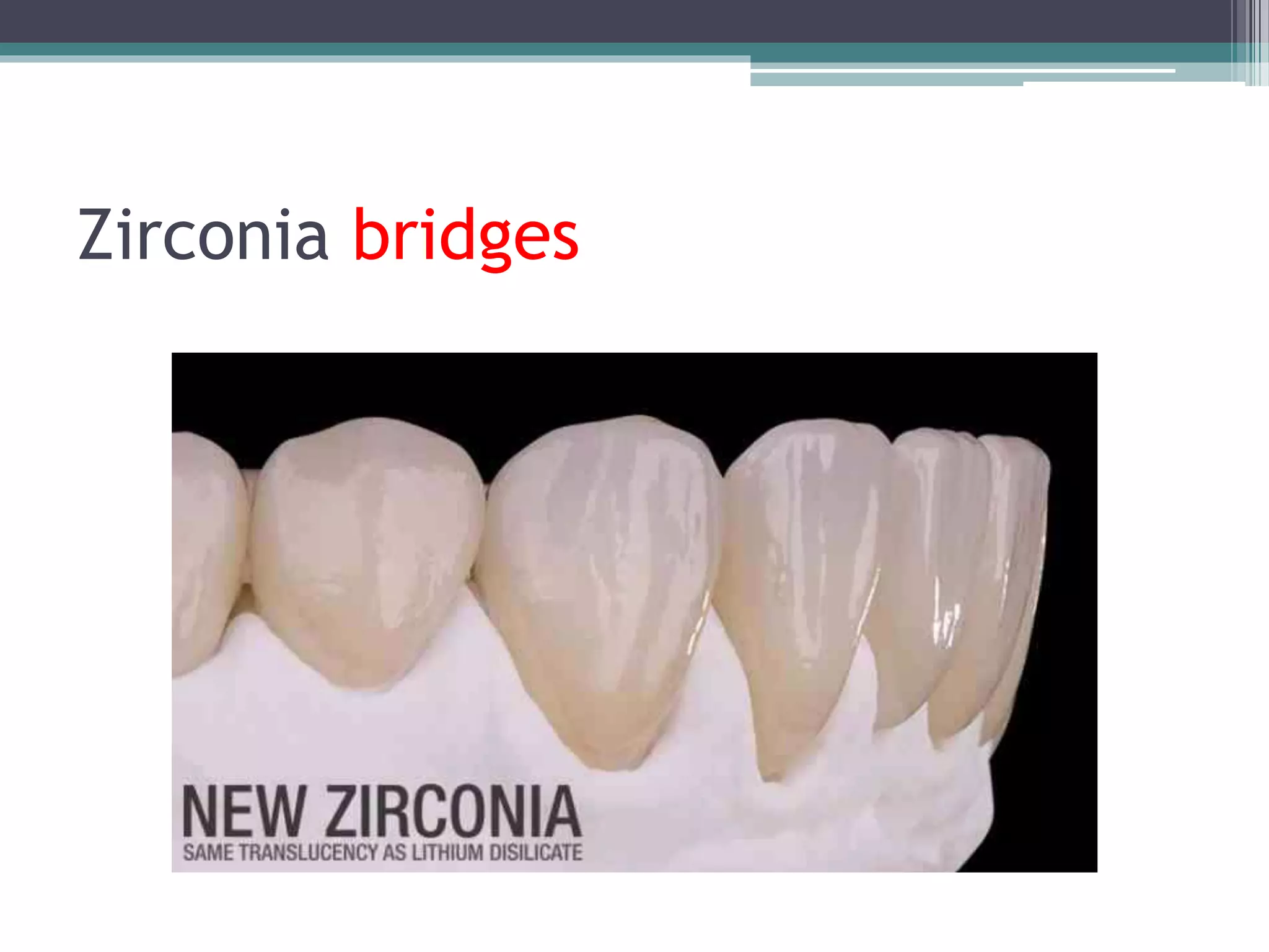 Zirconia overview | PPTX