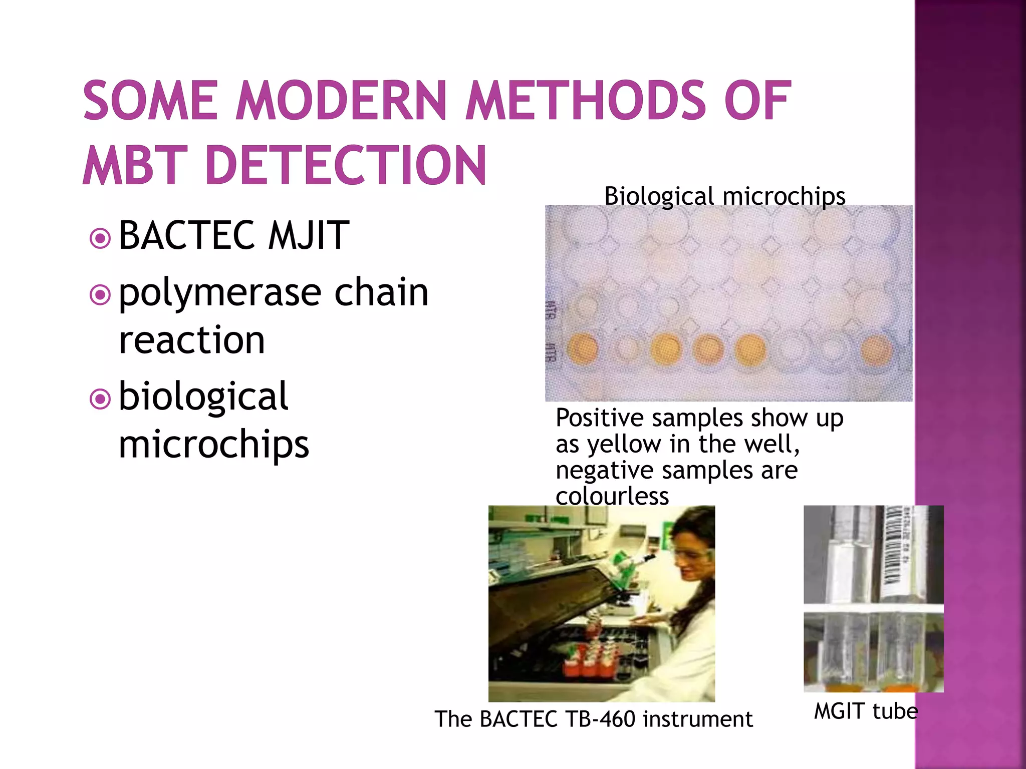 tuberculosis - CAVERNOUS TUBERCULOSIS | PPTX | Lung and Respiratory ...