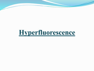 Eye Flourecein Angiography | PPTX