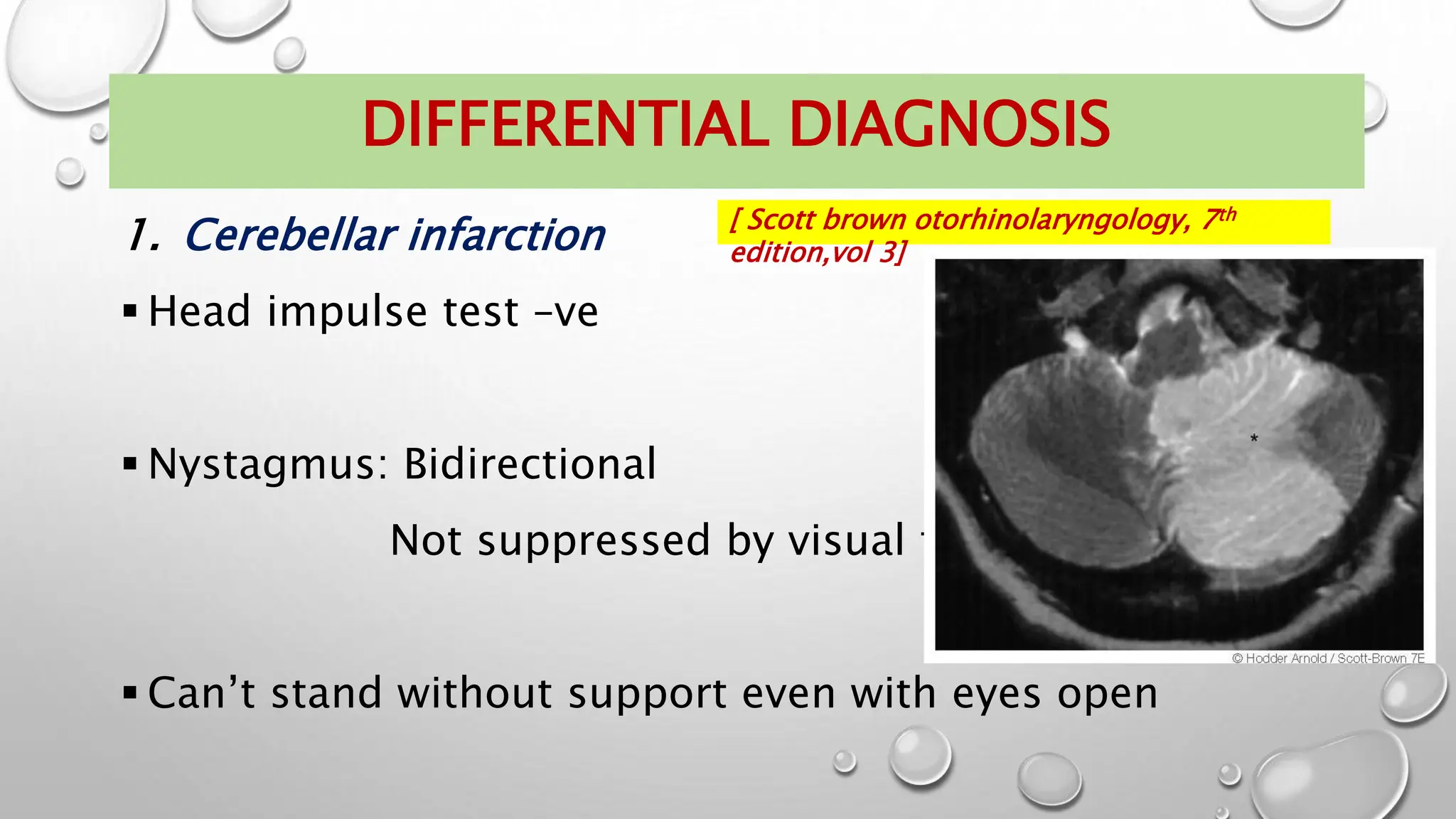 VESTIBULAR_NEURONITIS__bppv ent & hns.pptx