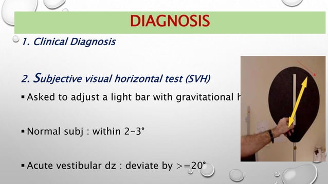 VESTIBULAR_NEURONITIS__bppv ent & hns.pptx | Brain and Nervous System ...