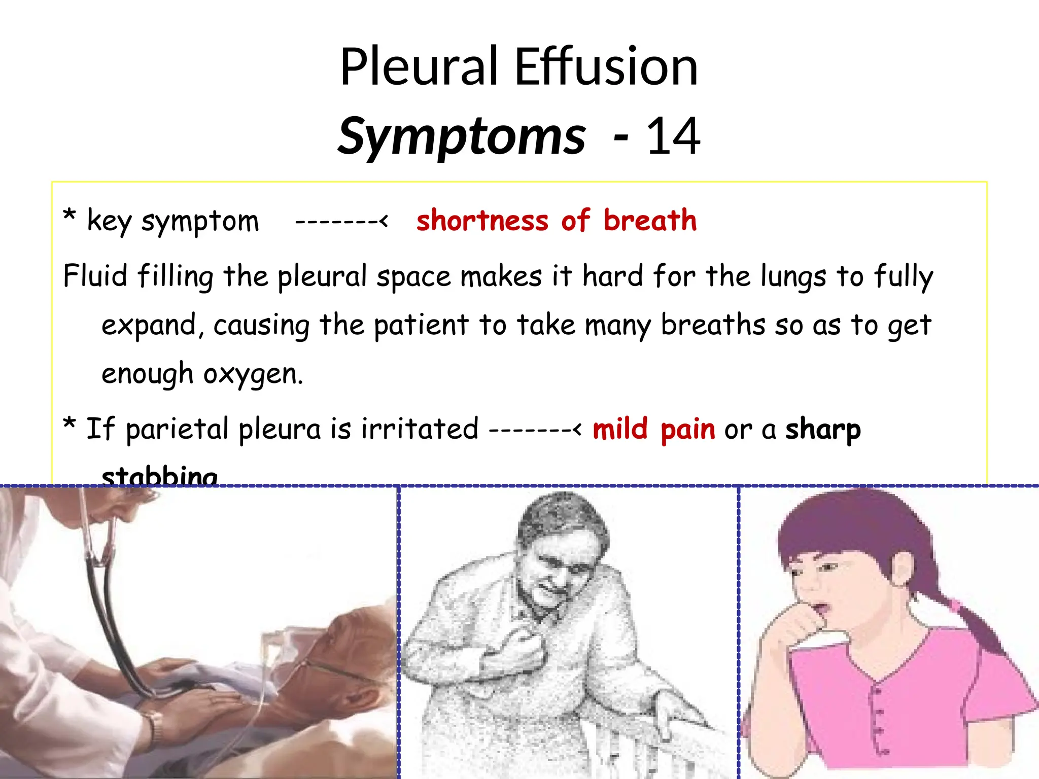 Zm-B411-L5-Pleural Effusion.ppt Zm-B411-L5-Pleural Effusion.ppt