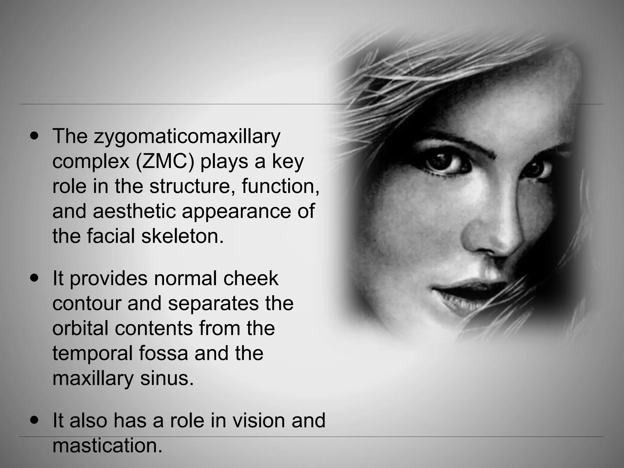 Midfacial fracture | PPTX