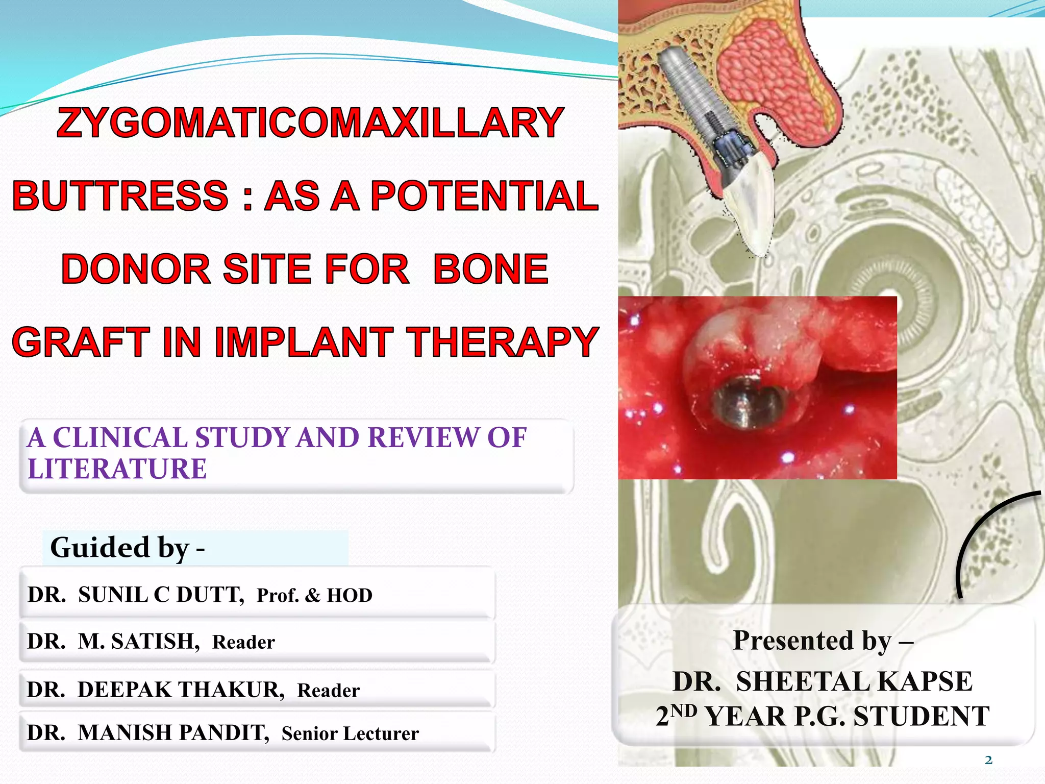 Zygomaticomaxillary buttress as a donor site | PPT
