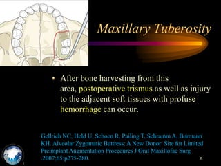 Zygomaticomaxillary buttress as a donor site | PPTX