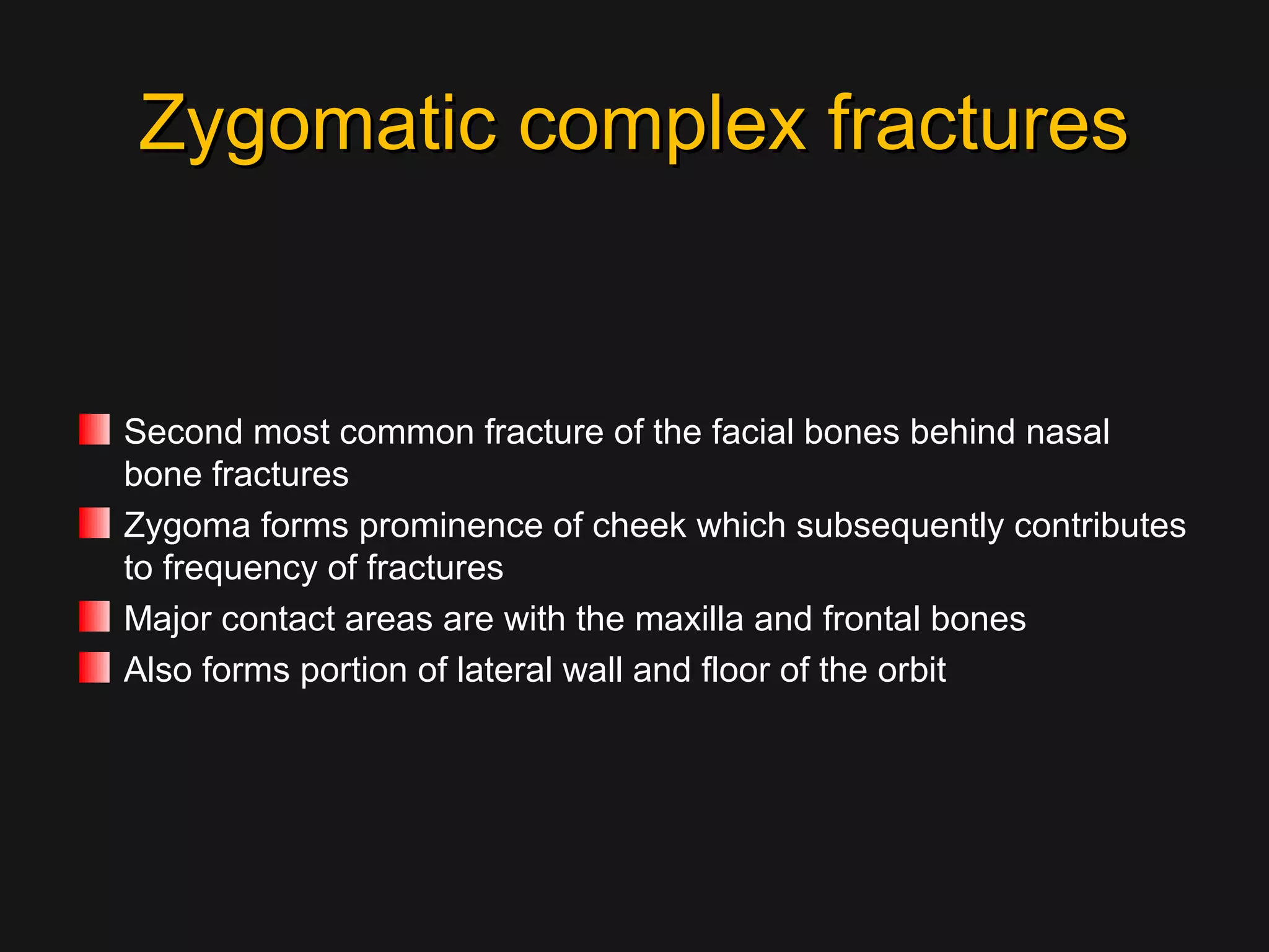 Zmc fracture..by Dr.GPK/ Dr.G.P.Kumar/Dr.G.Padmanabha Kumar | PPT