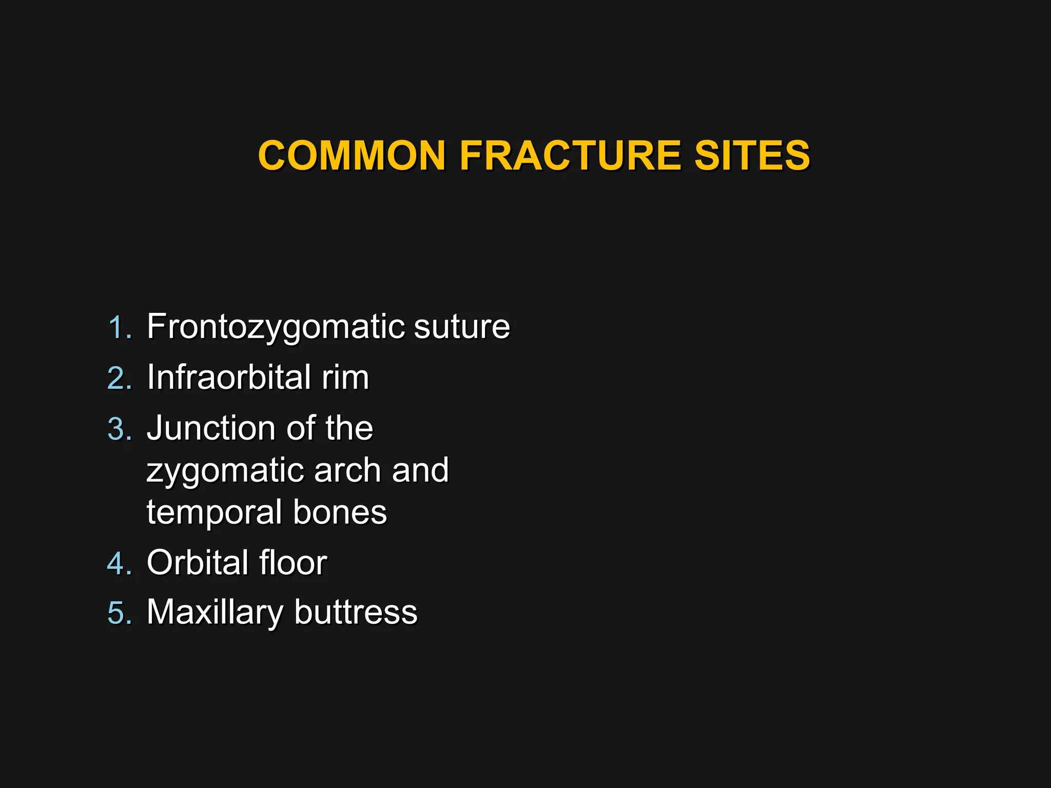 Zmc fracture..by Dr.GPK/ Dr.G.P.Kumar/Dr.G.Padmanabha Kumar | PPT