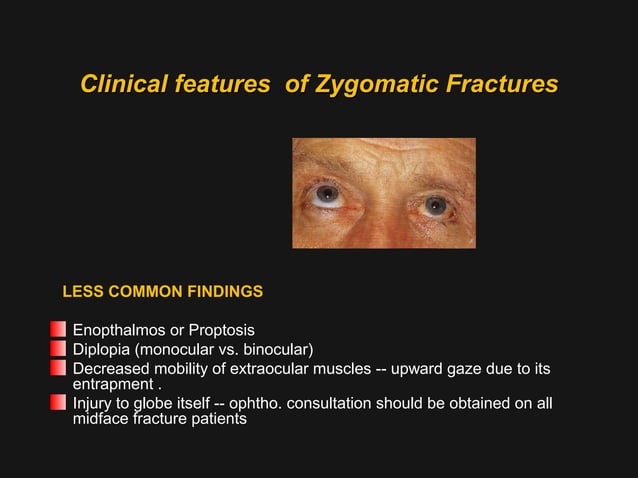 Zmc fracture..by Dr.GPK/ Dr.G.P.Kumar/Dr.G.Padmanabha Kumar | PPT ...