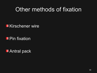 Zmc fracture..by Dr.GPK/ Dr.G.P.Kumar/Dr.G.Padmanabha Kumar | PPT